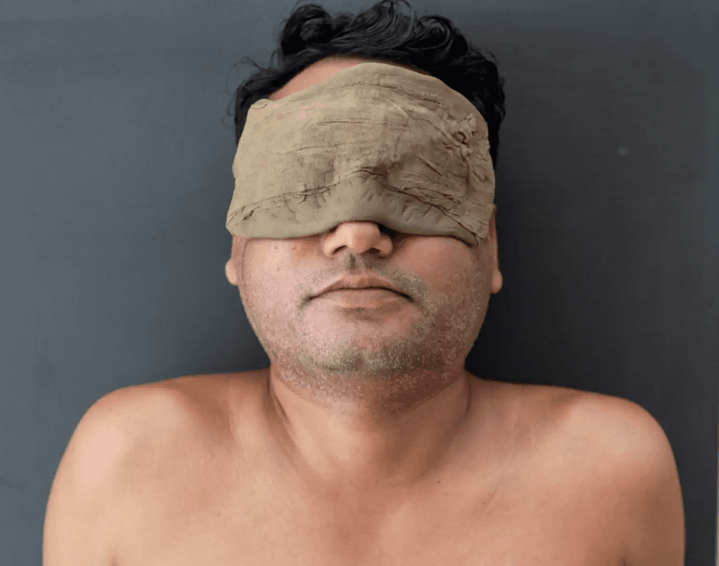 Mud Pack Treatment in Hyderabad | Patanjali Wellness